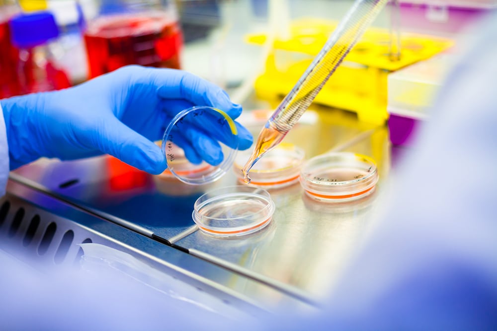Infection and Immunity | Research Themes | INRS